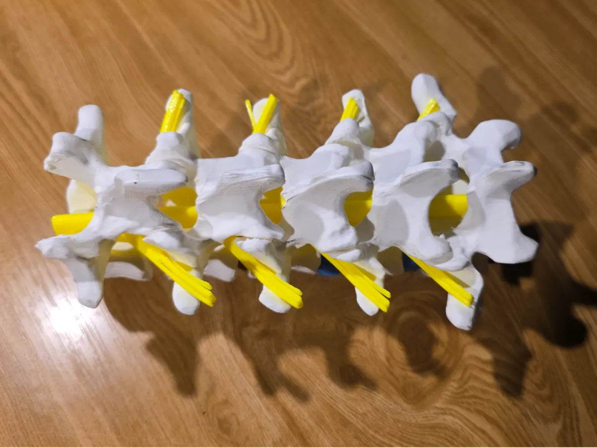 médula espinal y discos intervertebrales - Modelo de impresión 3D ...