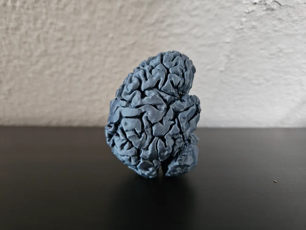 Personal Brain Anatomy - Print my Brain by andwoh MakerWorld: Download ...
