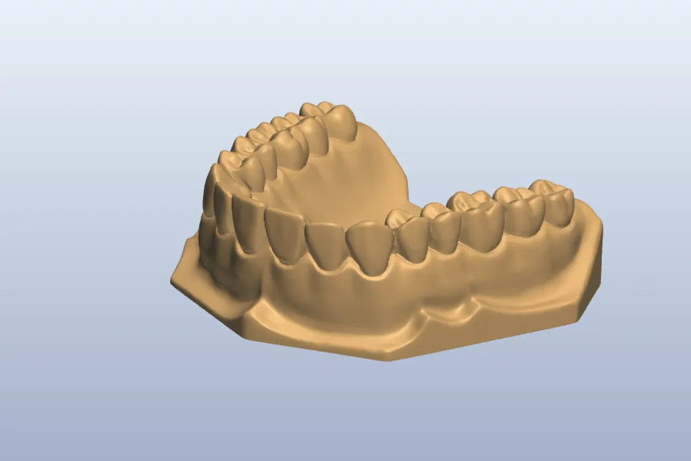 Upper arch dental study model by emilio MakerWorld: Download Free 3D Models