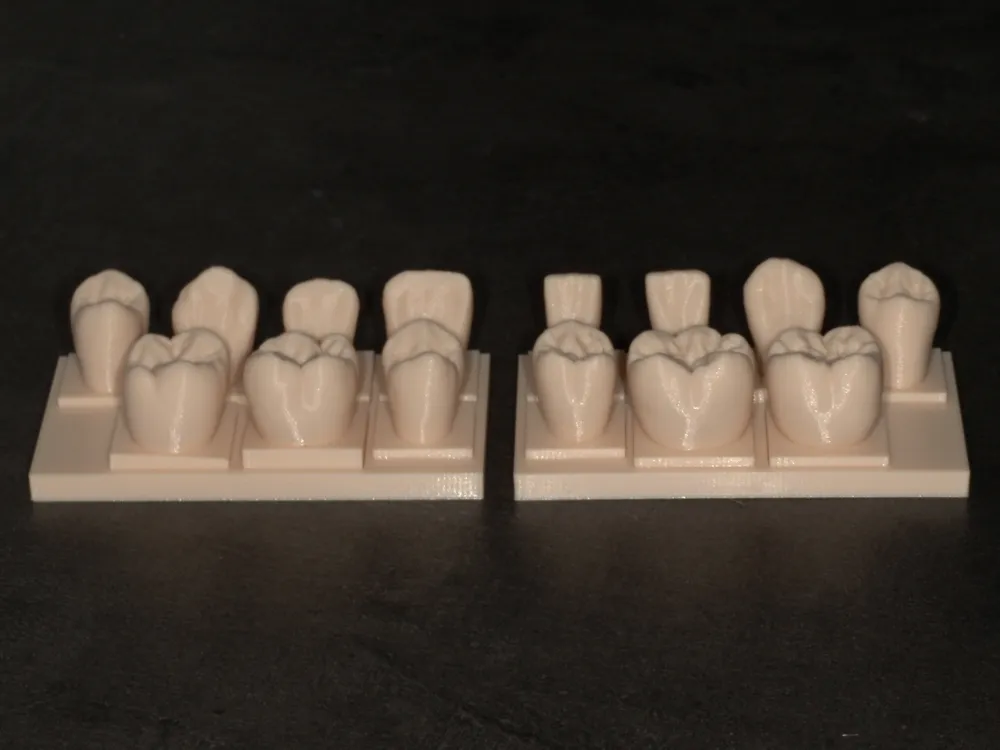 Mandibular Teeth (Display Model, Practice Model) - Free 3D Print Model ...
