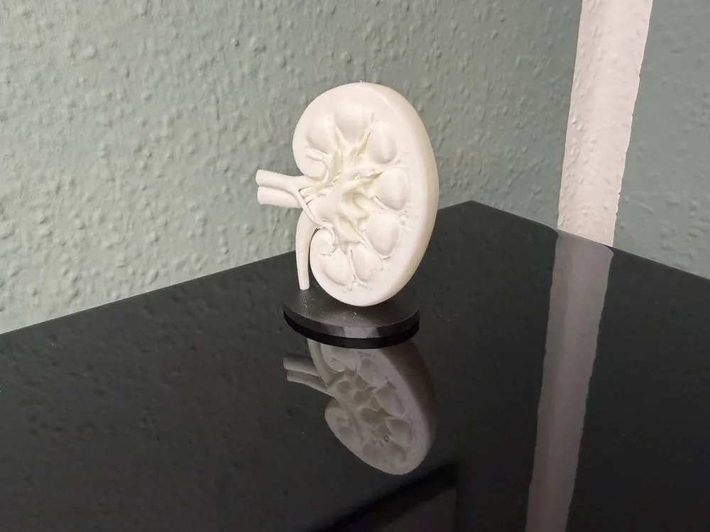 Kidney - Free 3D Print Model - MakerWorld