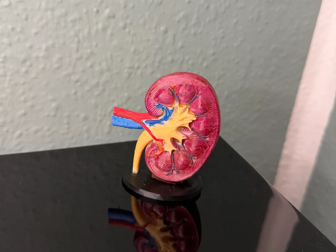 Kidney - Free 3D Print Model - MakerWorld