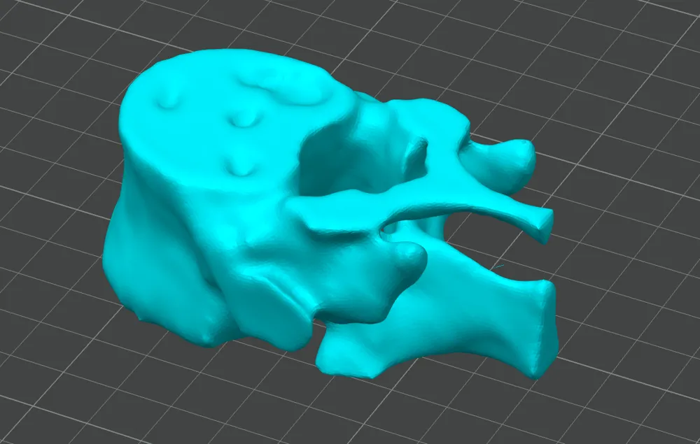 Real human spinal vertebra - from CT scan by Robin Wilson - MakerWorld