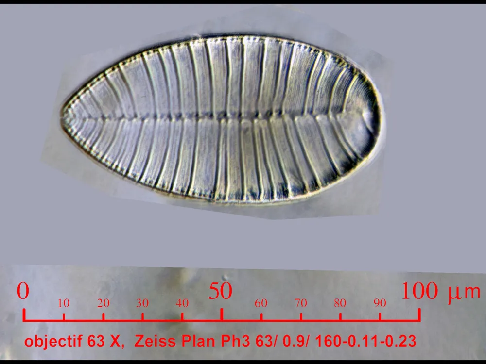 Diatom microphotography project - Free 3D Print Model - MakerWorld