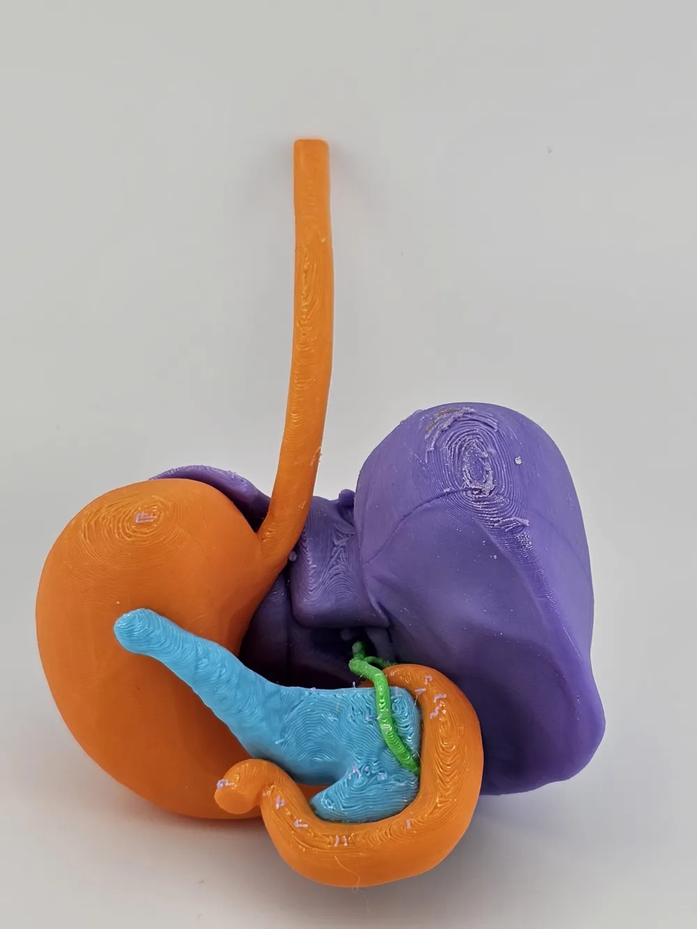 4-Color Anatomy: Upper Gastrointestinal Tract Remixed by Azrael ...