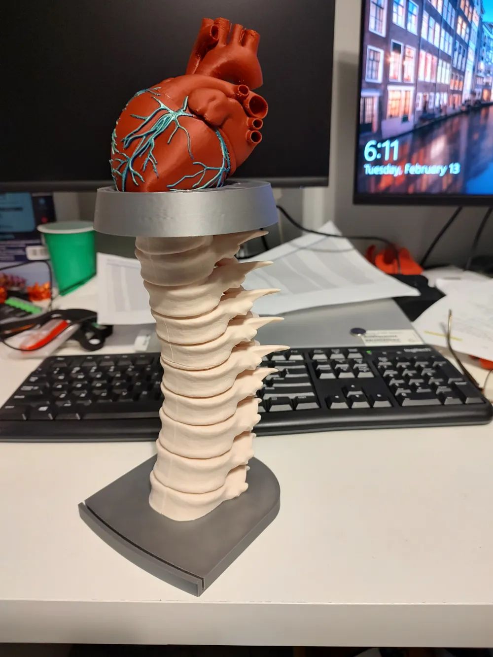 Cardiac Picture Frame by Yedoggie - MakerWorld