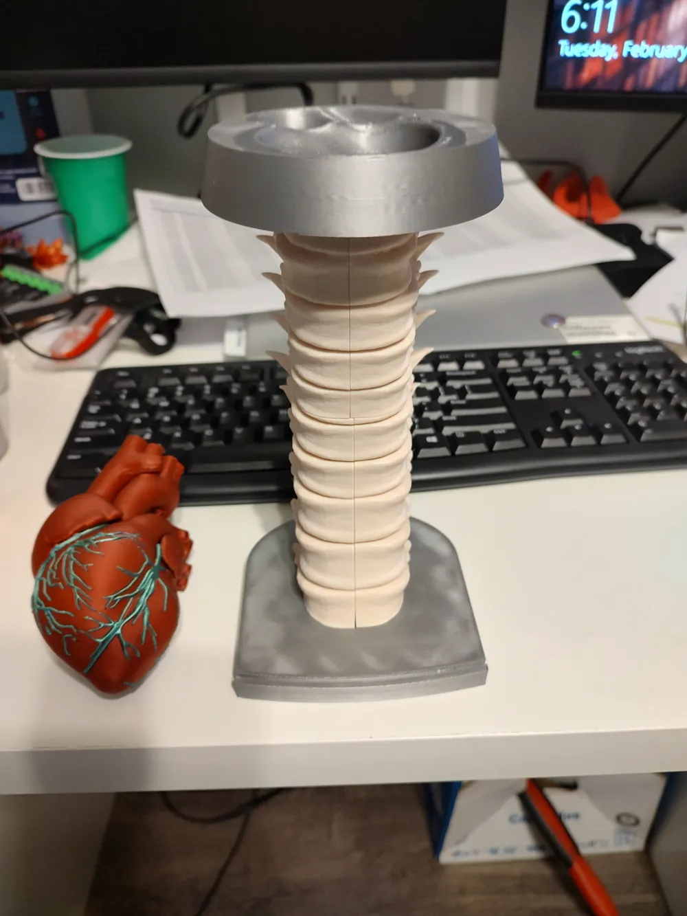 Cardiac Picture Frame by Yedoggie - MakerWorld