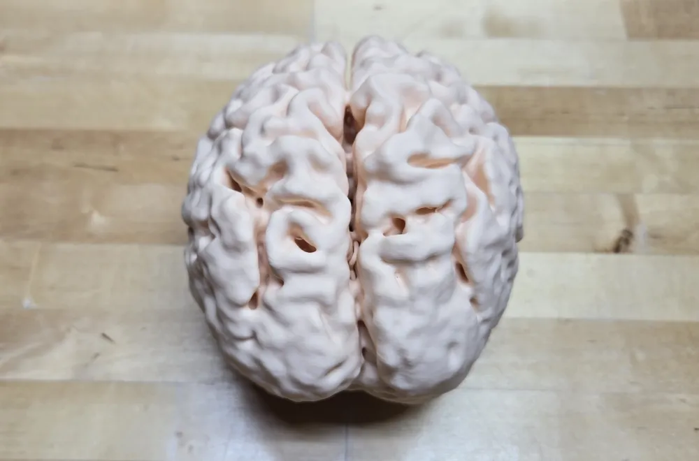 Full Scale Human Brain from MRI (My own brain) by Papadansmaman ...