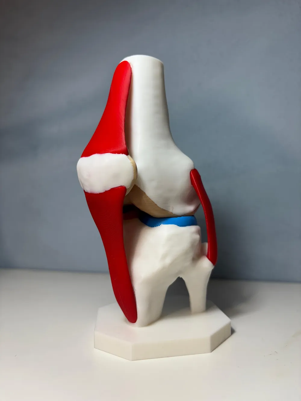 High-Precision Anatomical Knee Joint (CT scan) - Free 3D Print Model ...