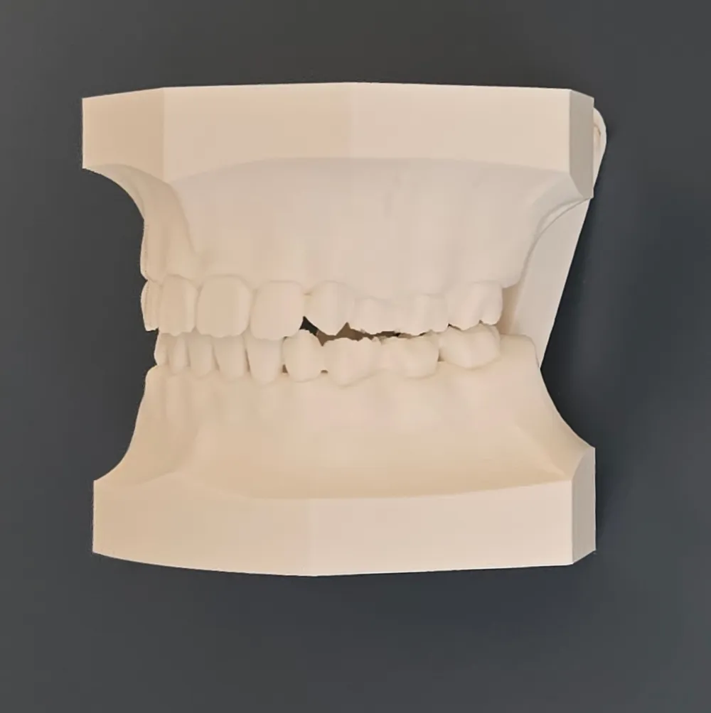 Mixed Dentition Typodont - Ideal Occlusion - Free 3D Print Model ...