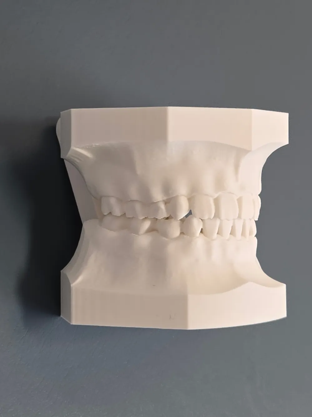Mixed Dentition Typodont - Ideal Occlusion - Free 3D Print Model ...