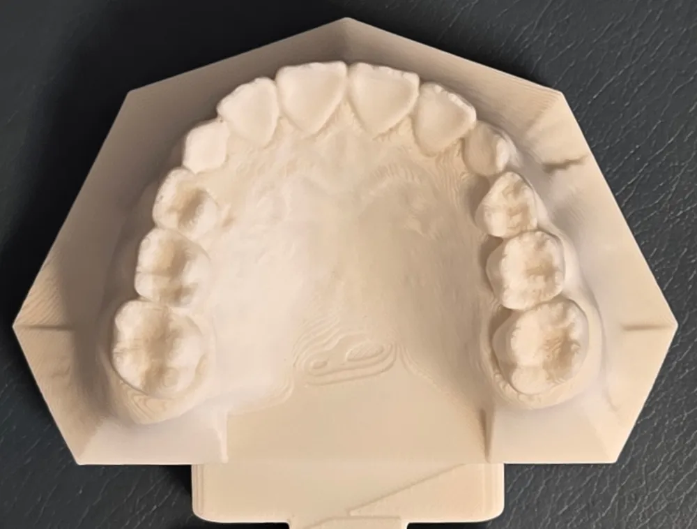 Mixed Dentition Typodont - Ideal Occlusion - Free 3D Print Model ...