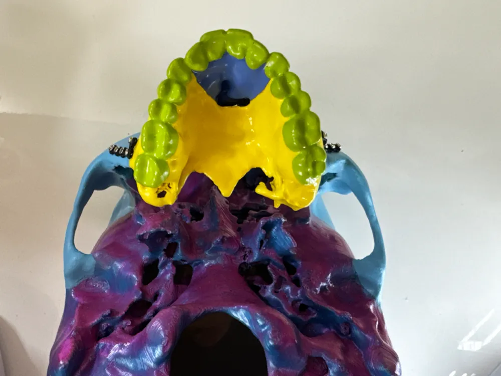 Orthognathic Surgery Anatomical Skull Model - Free 3D Print Model ...