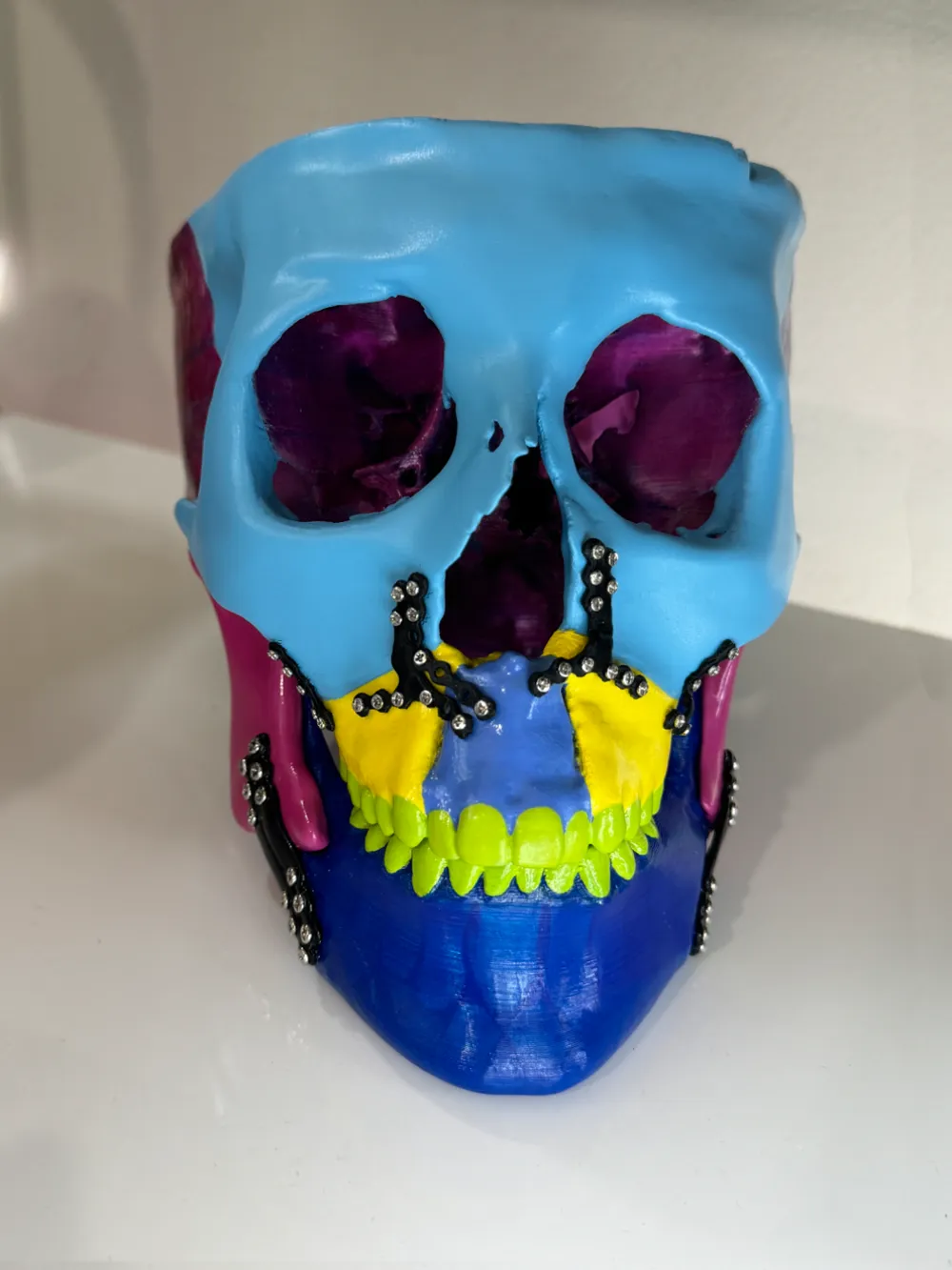 Orthognathic Surgery Anatomical Skull Model - Free 3D Print Model ...