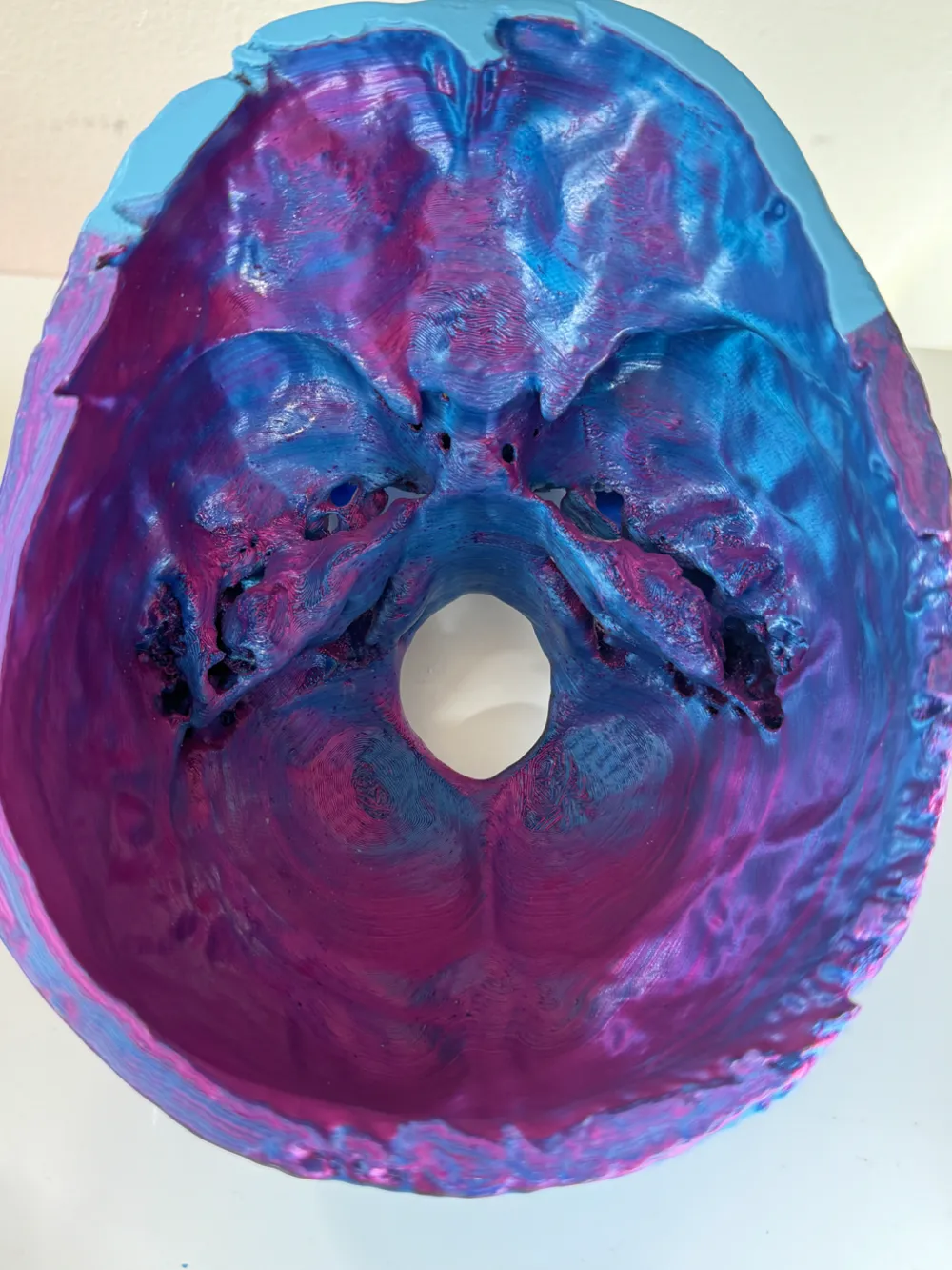 Orthognathic Surgery Anatomical Skull Model by Connor MakerWorld ...