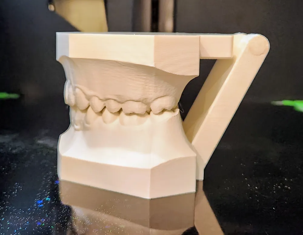 Permanent Dentition Typodont - Class I - Free 3D Print Model - MakerWorld