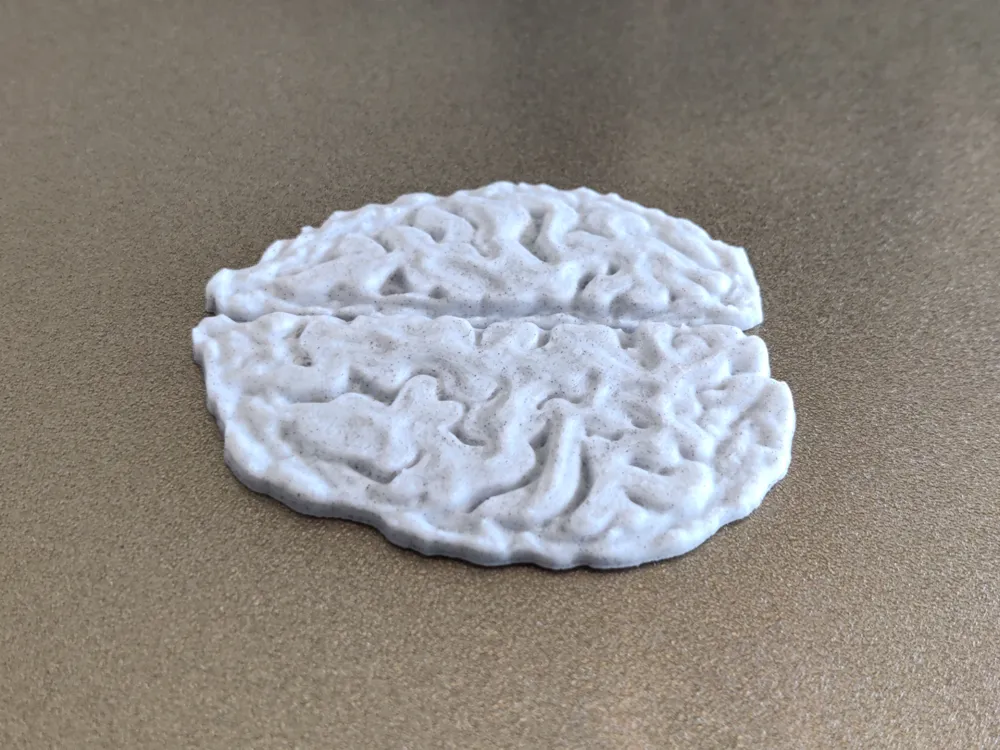 Brain Slice - MRI Scan by Levi Moore - MakerWorld
