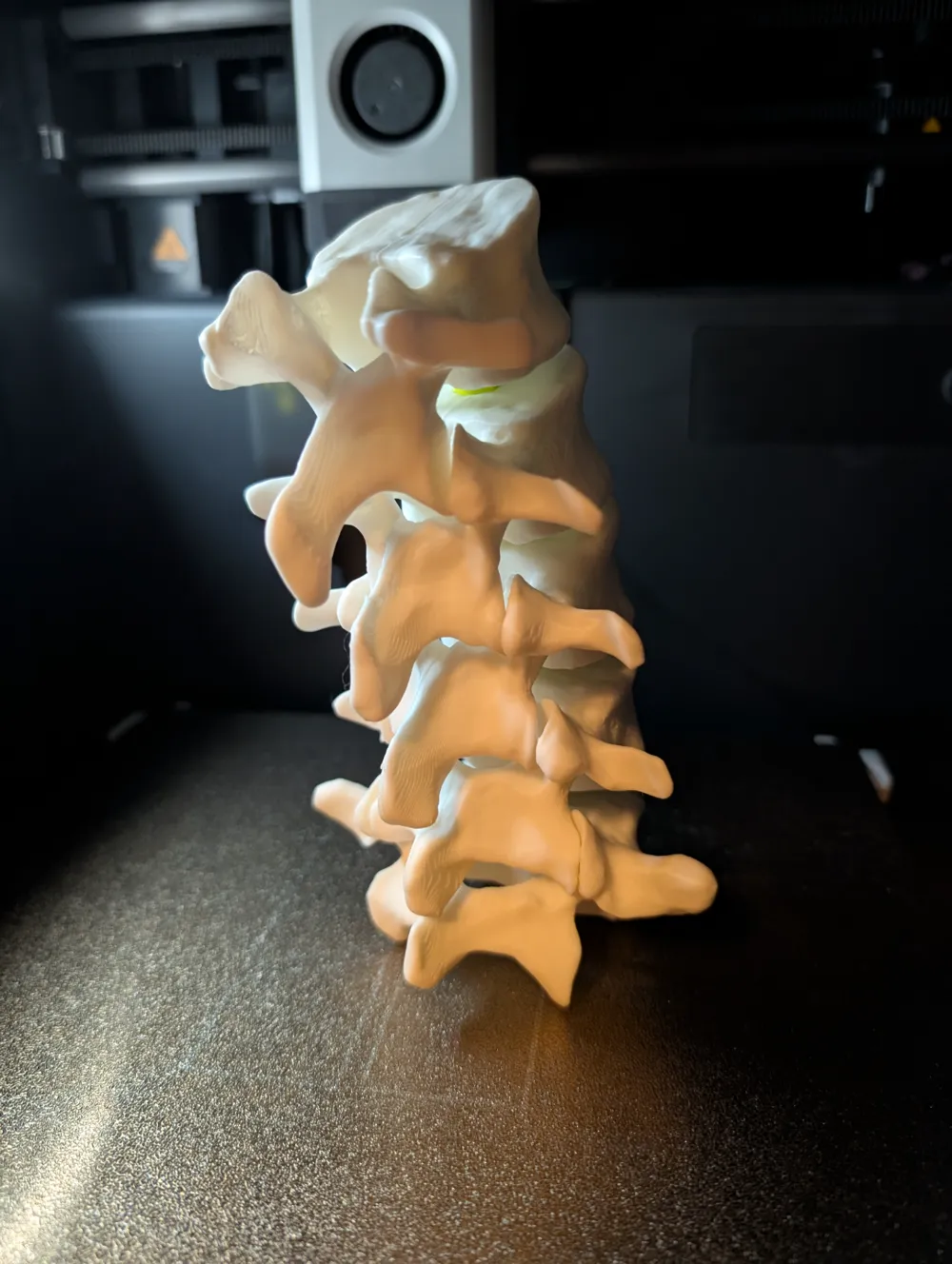 Articulating Lumbar Vertebrae Remixed by ToxicMegacolon MakerWorld ...
