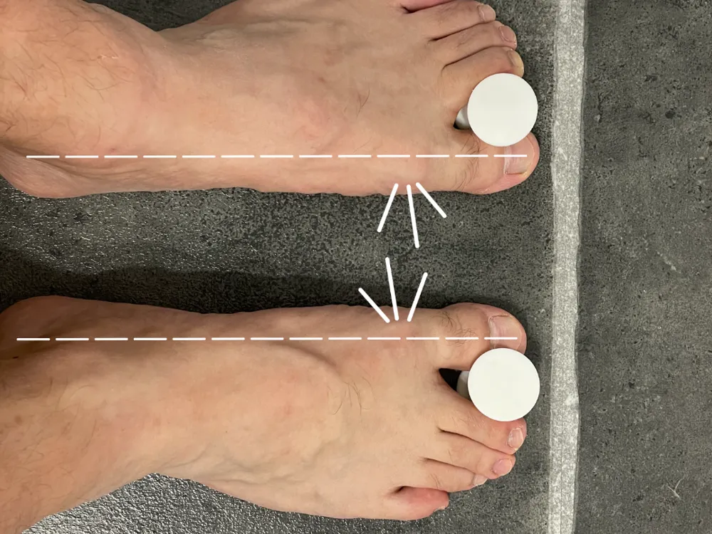 toes stretcher for exercises against flat feet by borisklimov - MakerWorld